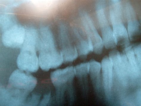 Рентген, x-ray texture background, текстура, фото, фон, скачать