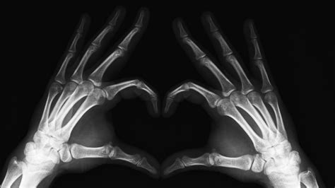 Рентген, x-ray texture background, текстура, фото, фон, скачать