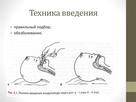 Особенности обеспечения проходимости дыхательных путей у детей ...
