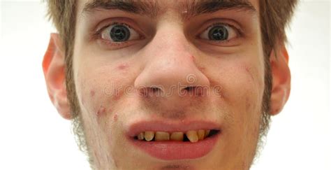 Ugly Smile Images