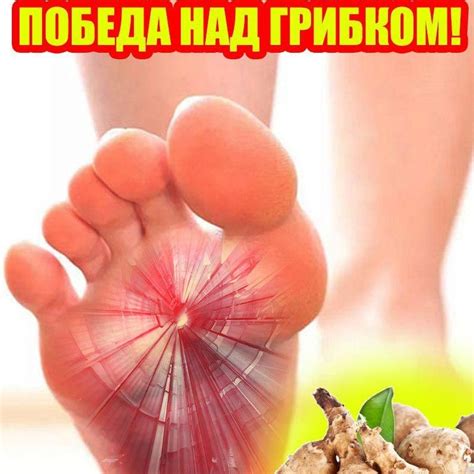 Анти Грибок