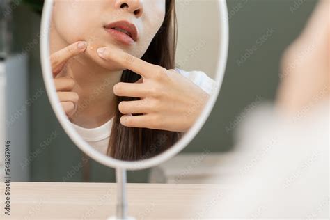 Expression worry asian young woman hand touching pustule around the chin and mouth, allergic ...