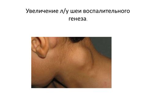 Непосредственное обследование кожи и слизистых оболочек - презентация ...