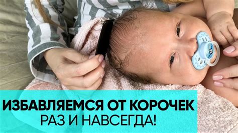 КАК УБРАТЬ КОРОЧКИ НА ГОЛОВЕ У МАЛЫША? Пошаговая инструкция для ...