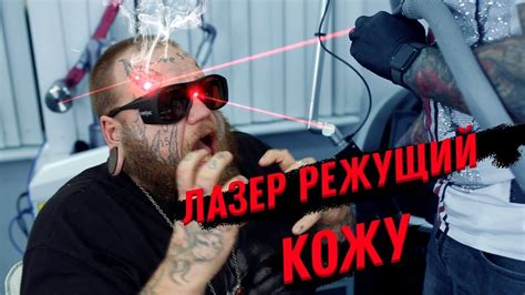 Удаляю САТАНИНСКУЮ НАДПИСЬ НА ЛБУ | Лазер стоимостью как FERRARI - YouTube
