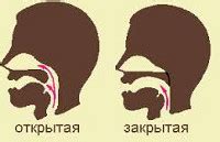 Ринолалия - причины, симптомы, диагностика и лечение