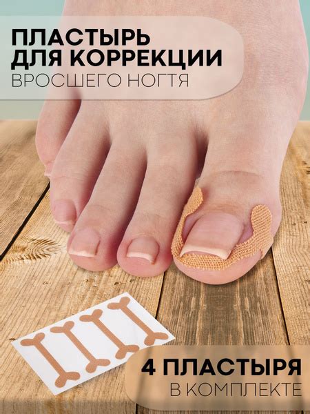 Пластырь от вросших ногтей (корректор против врастания ногтей), бренд ...