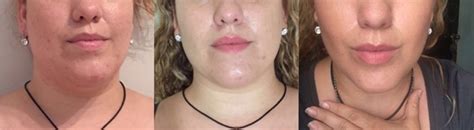 Medicaltrading | PB Serum