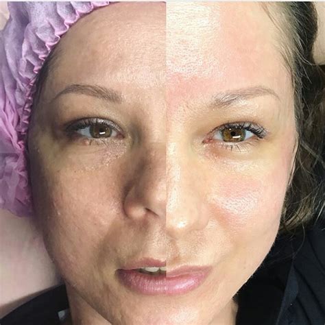 Что такое bb glow? Купить сыворотки bb glow.