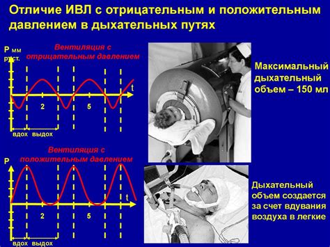 Основы ИВЛ - презентация онлайн