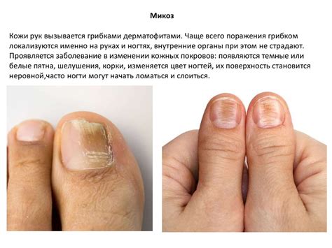 Наращивание ногтей на верхние формы - презентация онлайн