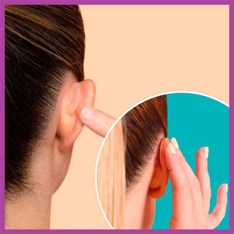 Otostick - Otostick USA | Aesthetic Ear Corrector