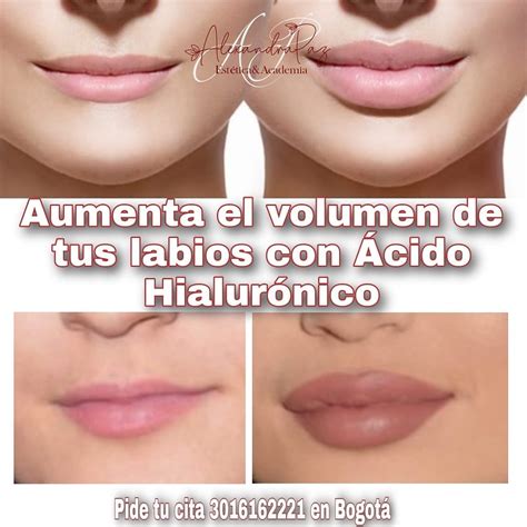 💋 Aumenta el volumen de tus labios... - Academy Alexandra Paz | Facebook