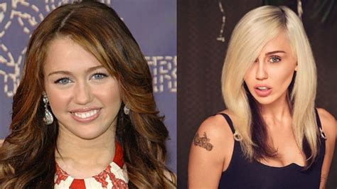 Miley Cyrus: The Truth Behind Plastic Surgery Rumors