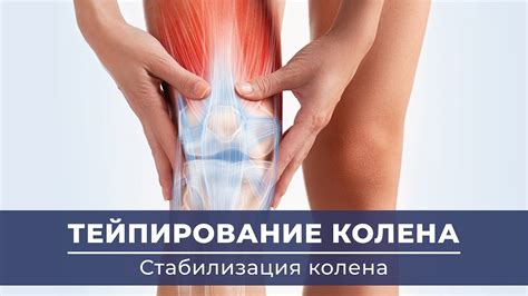 Тейпирование колена. Тейпирование ноги. Тейпирование при болях ...