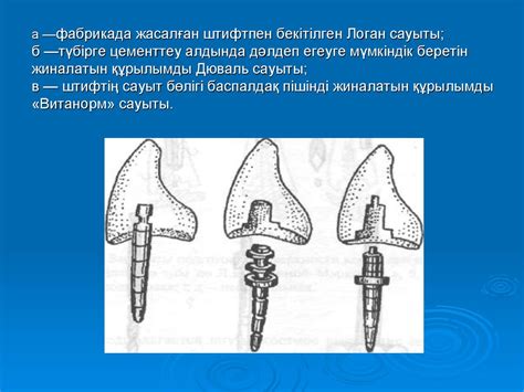 Штифті тістерді жасау технологиясы. Жіктелуі - презентация онлайн