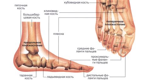 Плоскостопие - причины, лечение и профилактика у детей и взрослых.