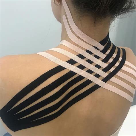 Тейпирование шеи | Kinesio taping, Kinesiology taping, Kinesio taping ...
