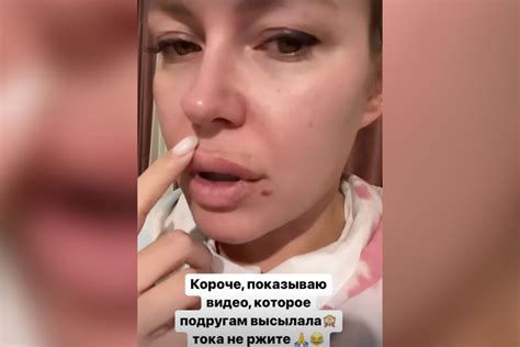 Рита Дакота впервые увеличила губы и показала результат - Газета.Ru ...
