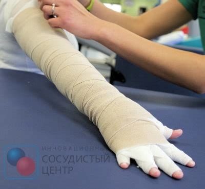 Лимфостаз руки - лечение в Инновационном сосудистом центре: как лечить ...