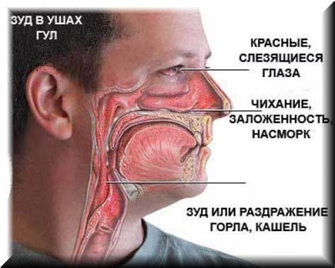 Аллергия на пыльцу злаковых трав - Аллергология и Иммунология