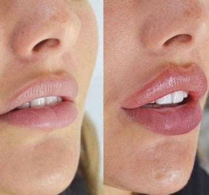 Stylage M (Стилейдж М) для губ. Цена, отзывы — Женские Секреты: красота ...