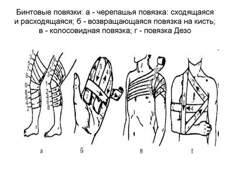 Десмургия.Принципы иммобилизации - презентация онлайн