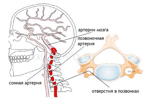 Синдром вертебро-базилярной артериальной системы | Altmed