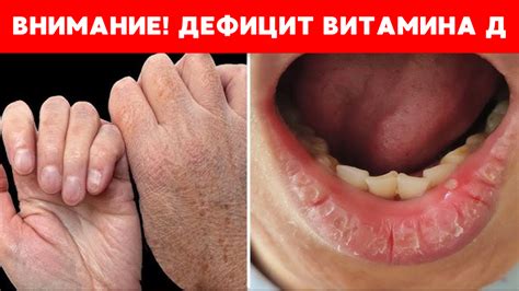 Организм предупреждает нас: 8 признаков того, что вашему телу не ...